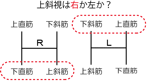 Parksの3段階法 – 目医者情報