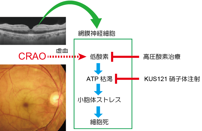 CRAOの最新治療 – 目医者情報